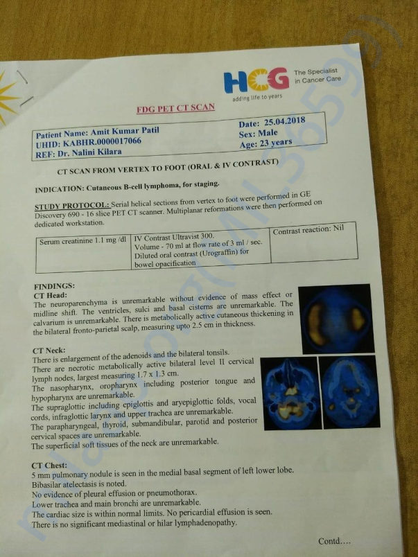 Ct Scan Reports - Blood Cancer Report Vikas Kumar - 603x804 Wallpaper ...