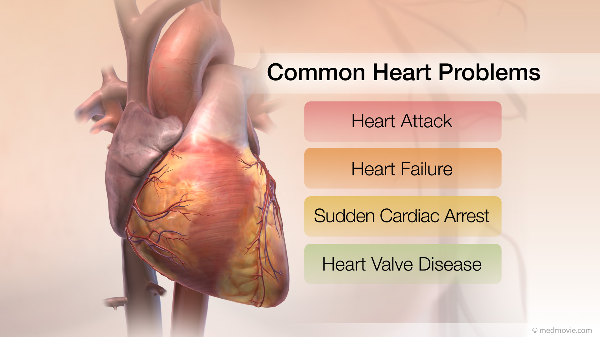 Common Heart Problems - 1920x1080 Wallpaper - teahub.io