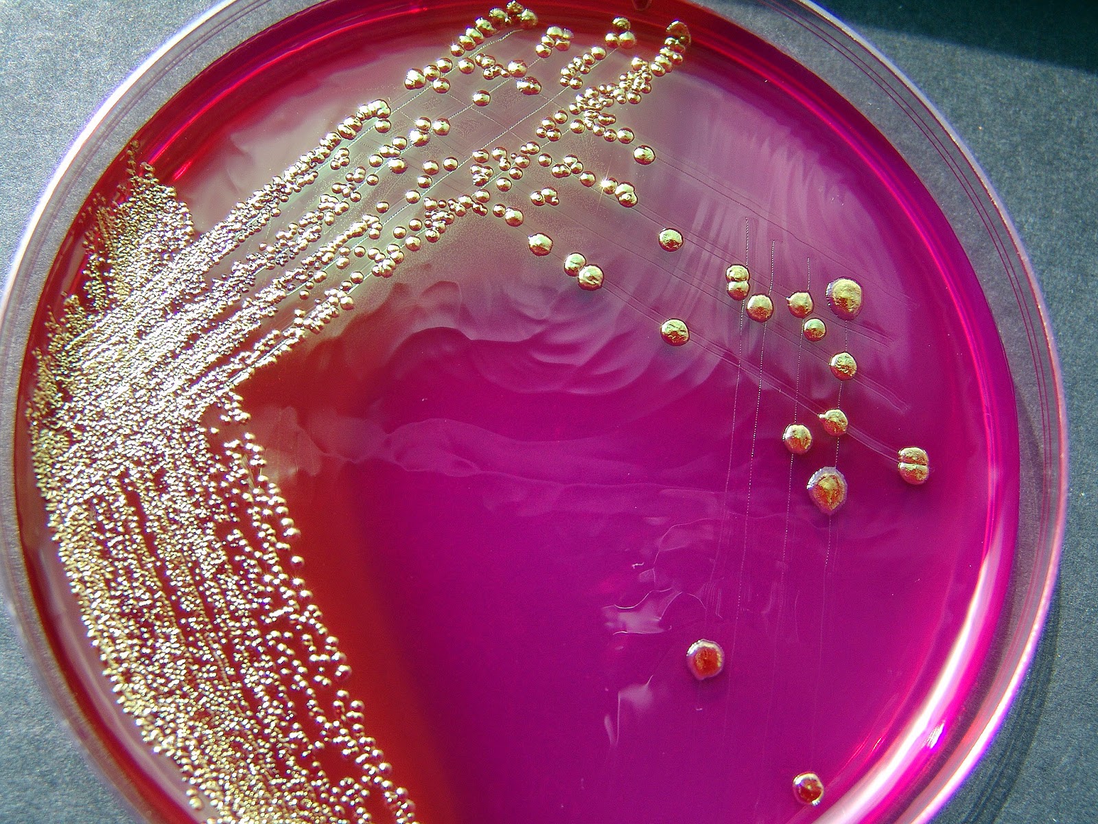 Microbiology E Coli Plate - 1600x1200 Wallpaper - teahub.io