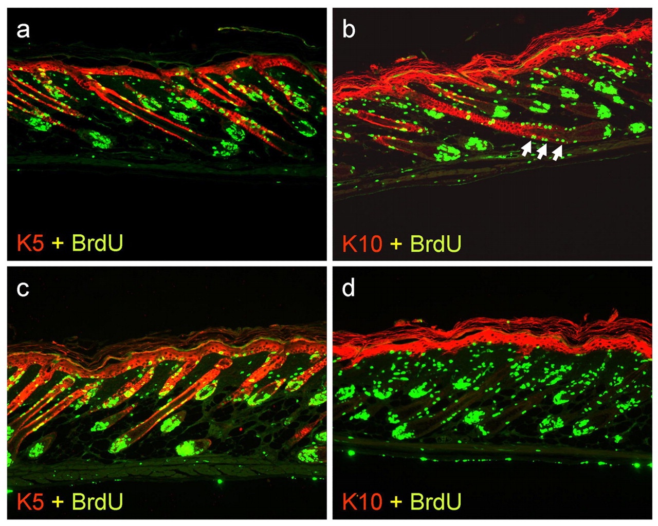 Keratin 14 Expression Skin - 1280x1024 Wallpaper - teahub.io